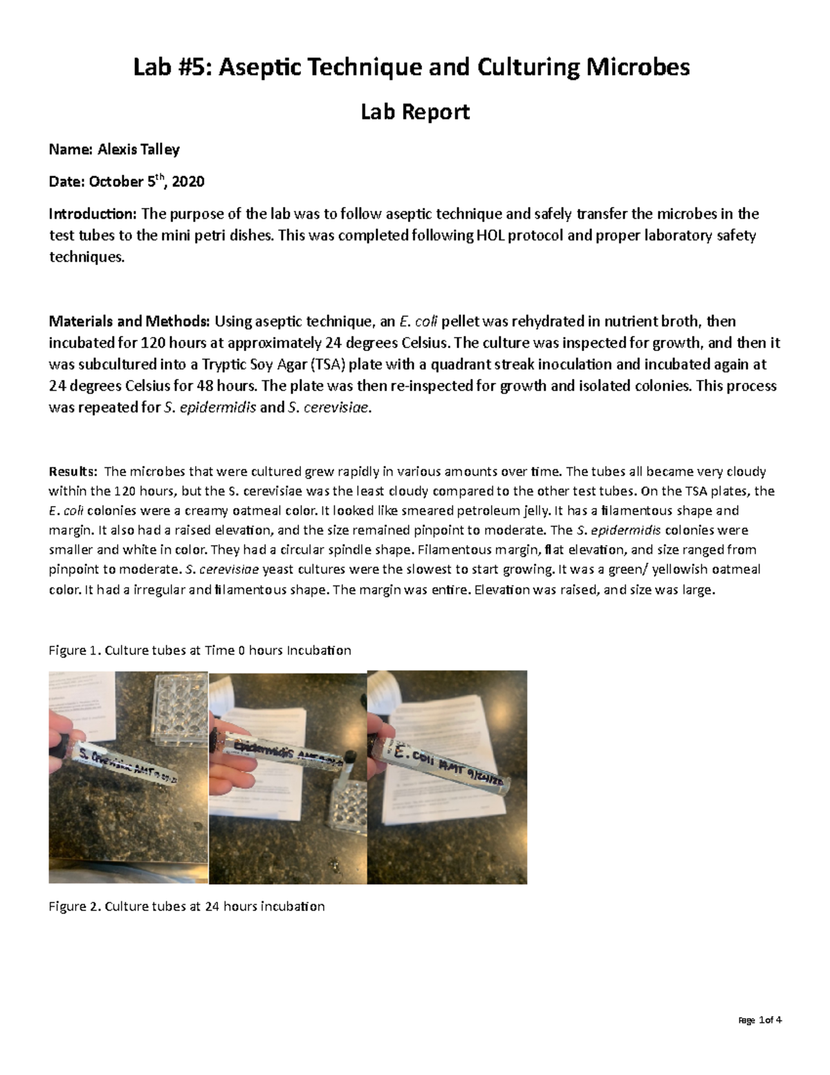 Microbiology Lab 5 Report: Aseptic Techniques & Microbe Culturing - Studocu