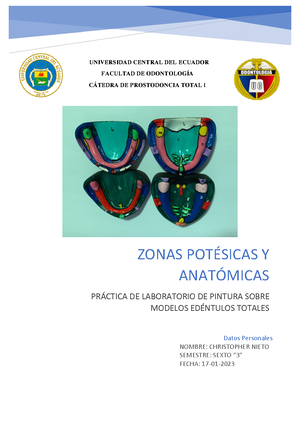 Láminas de Rexed - Láminas de Rexed Las láminas de Rexed son una ...