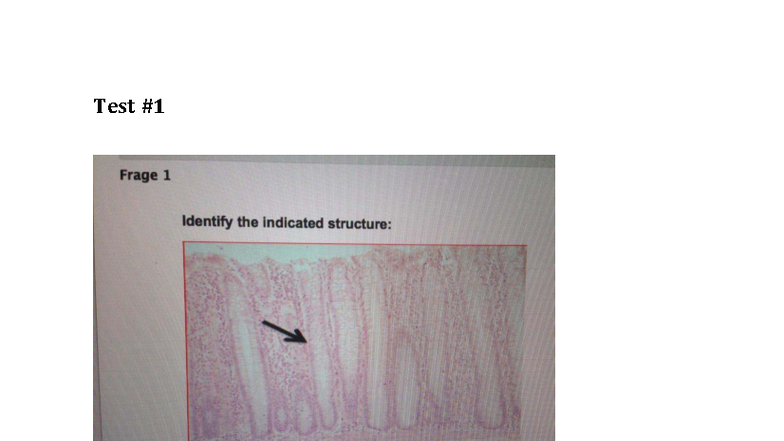 Microanatomy Test: Intestinal Glands & Muscle Types (8Splancho) - Studocu