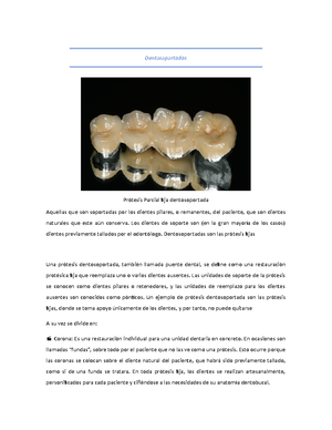 Retenedores PPR - ppr - Prótesis parcial removible (Retenedores) 1 ...