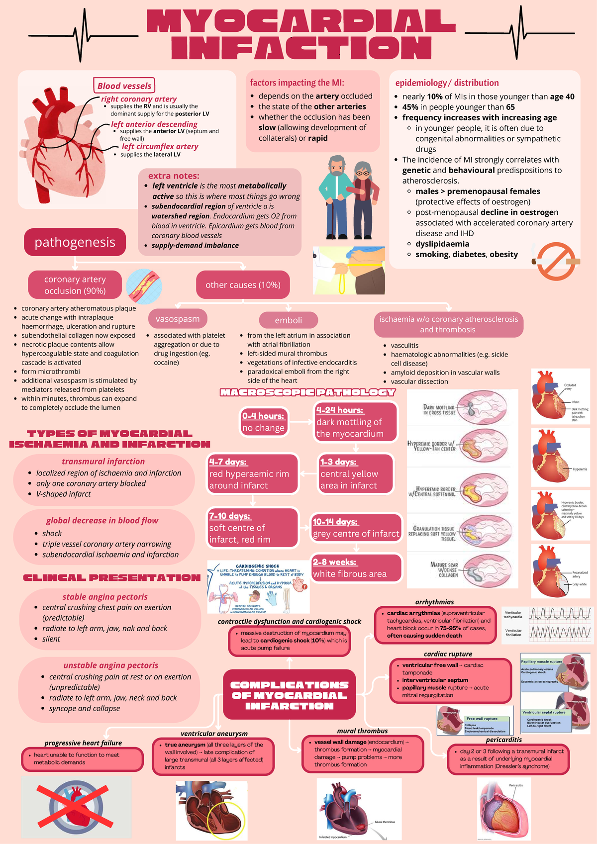 Myocardial Infarction Notes: Key Factors, Pathogenesis, and ...