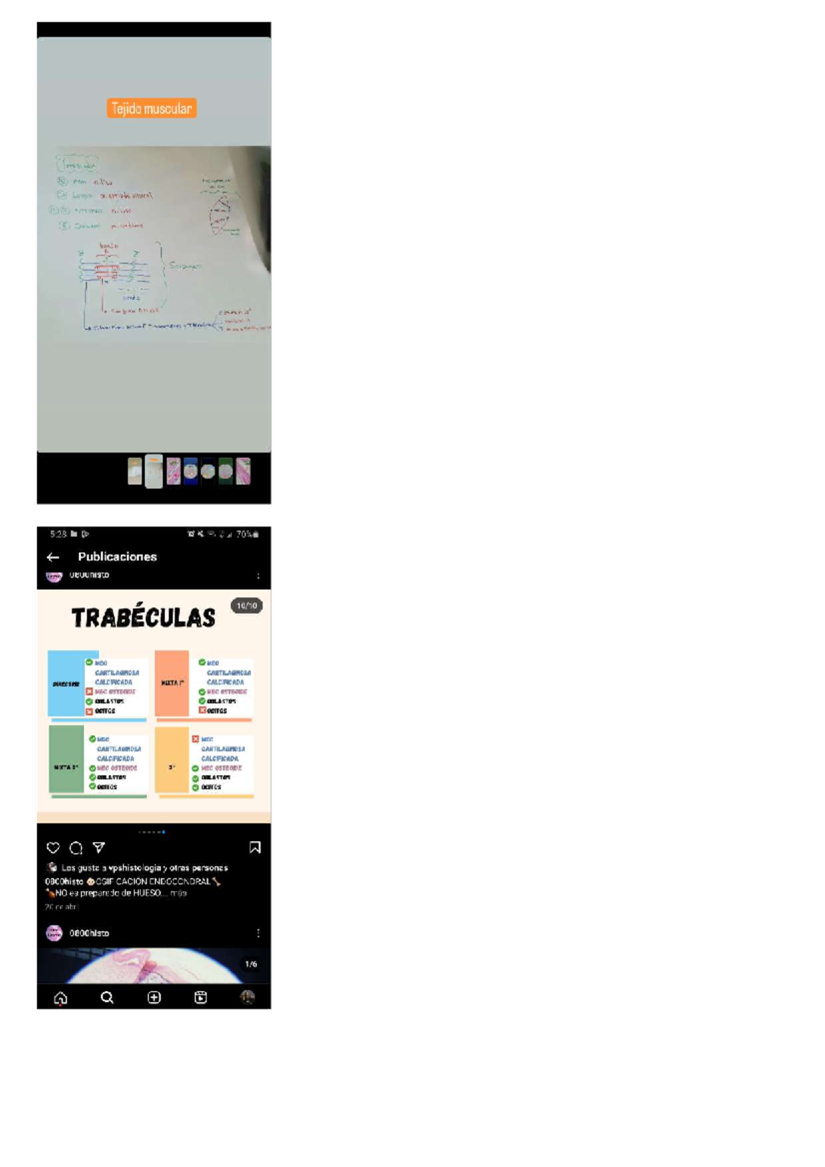 Histo - fotos da aula - Tejido muscular reported 15 item liso 2 Lenour ...