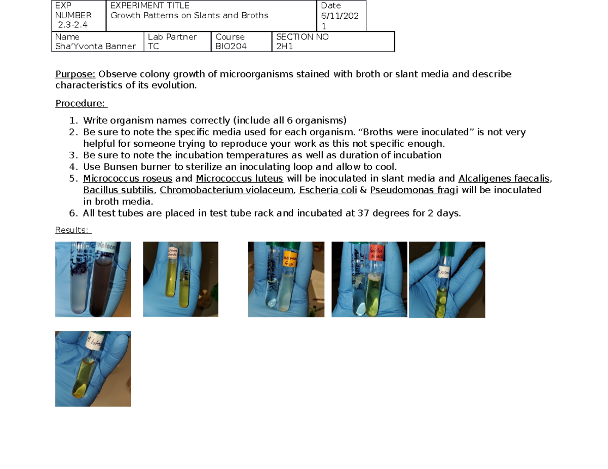 Growth Slants Broth Lab Report for Microbiology 204 - EXP NUMBER 2-2 ...