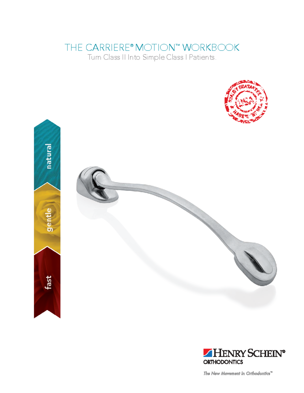 Carriere Motion Appliance: Simplifying Class II to Class I Treatment ...