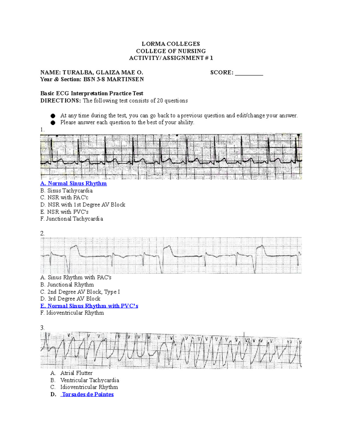 ECG Interpretation Activity #1 - Basic Practice Test for BSN 3-8 - Studocu