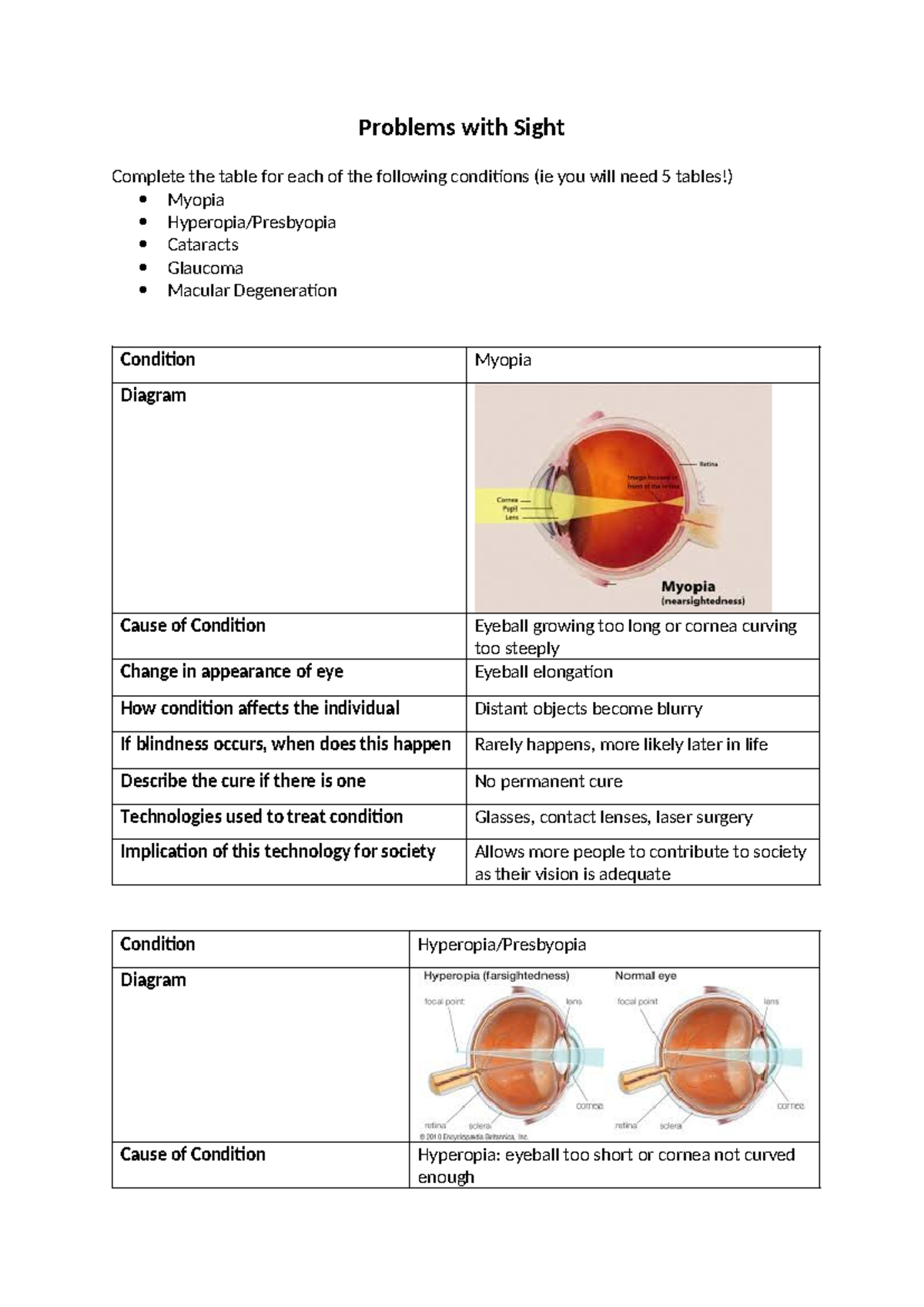 35. Conditions Affecting Vision: Myopia, Cataracts, Glaucoma, AMD - Studocu