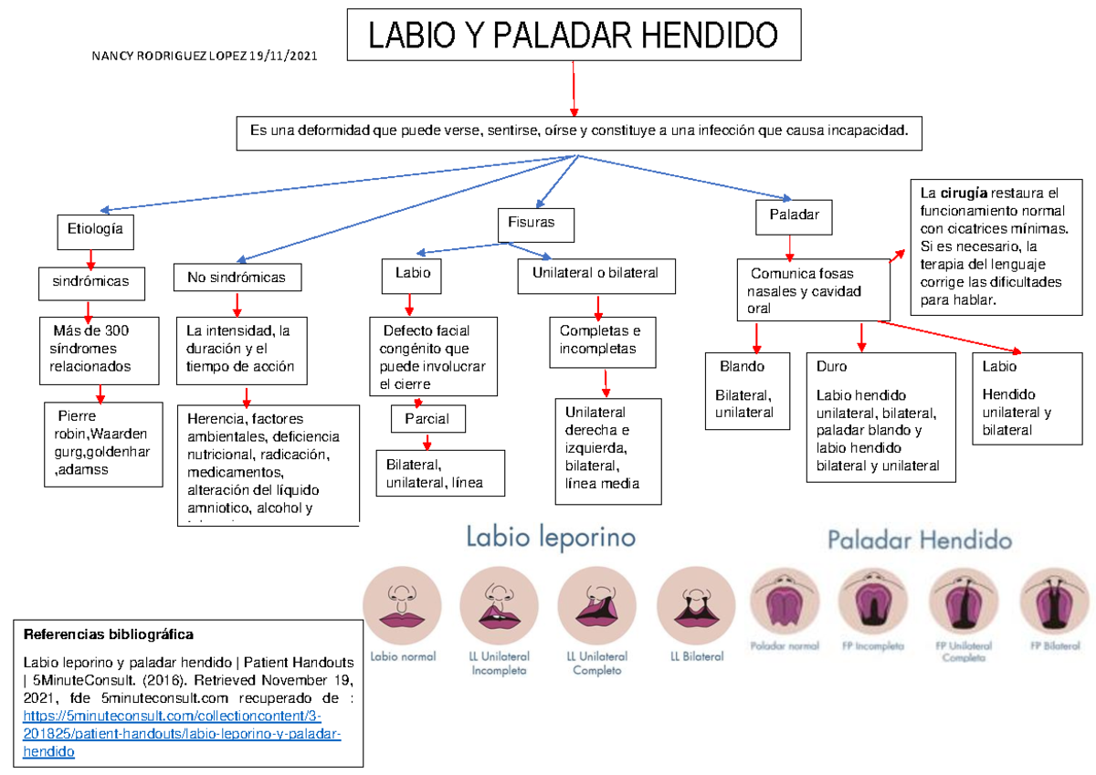 Mapa Conceptual: Labio y Paladar Hendido, Apendicitis - Nancy R. López ...