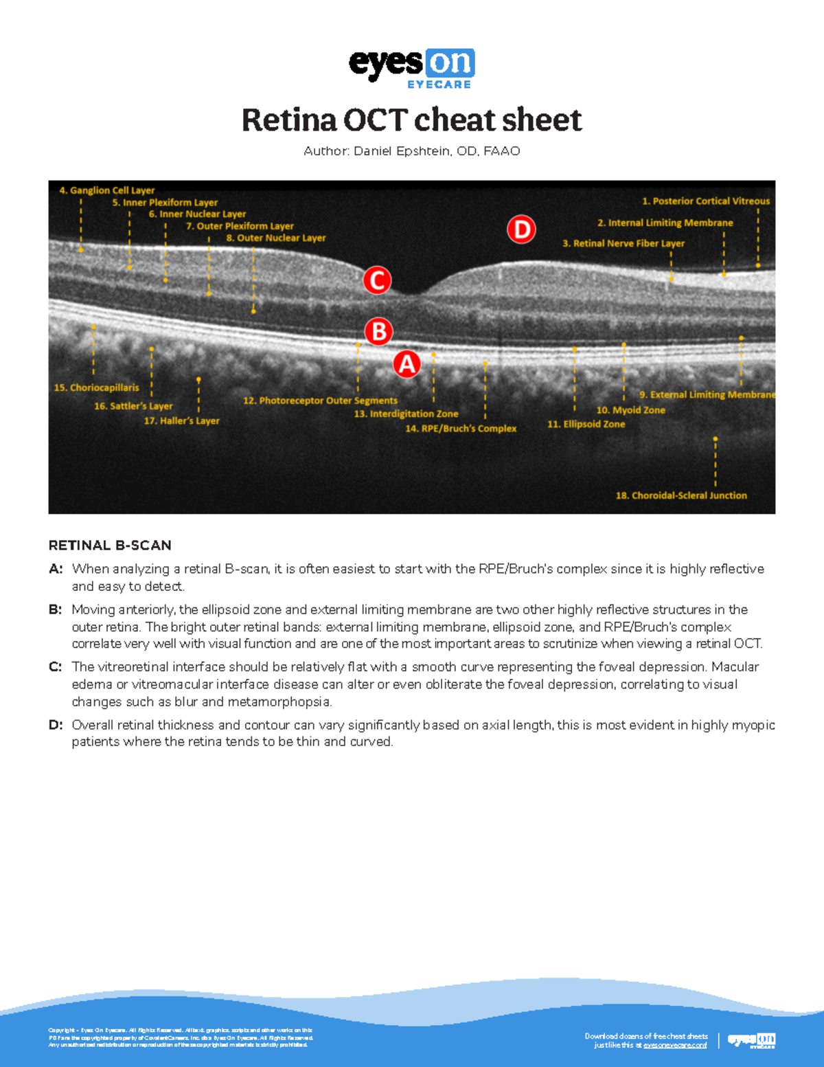 Retina OCT B-Scan Analysis Cheat Sheet for Optometry (Daniel Epshtein ...