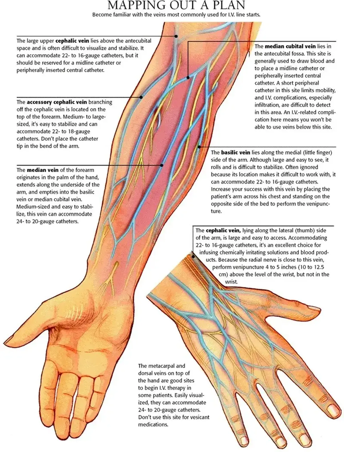 IV Insertion Techniques and Considerations for Patient Safety - Studocu