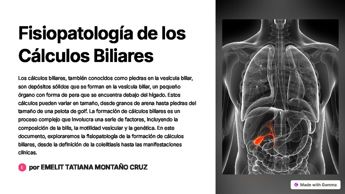 Fisiopatología de los Cálculos Biliares en la Vesícula Biliar - Studocu