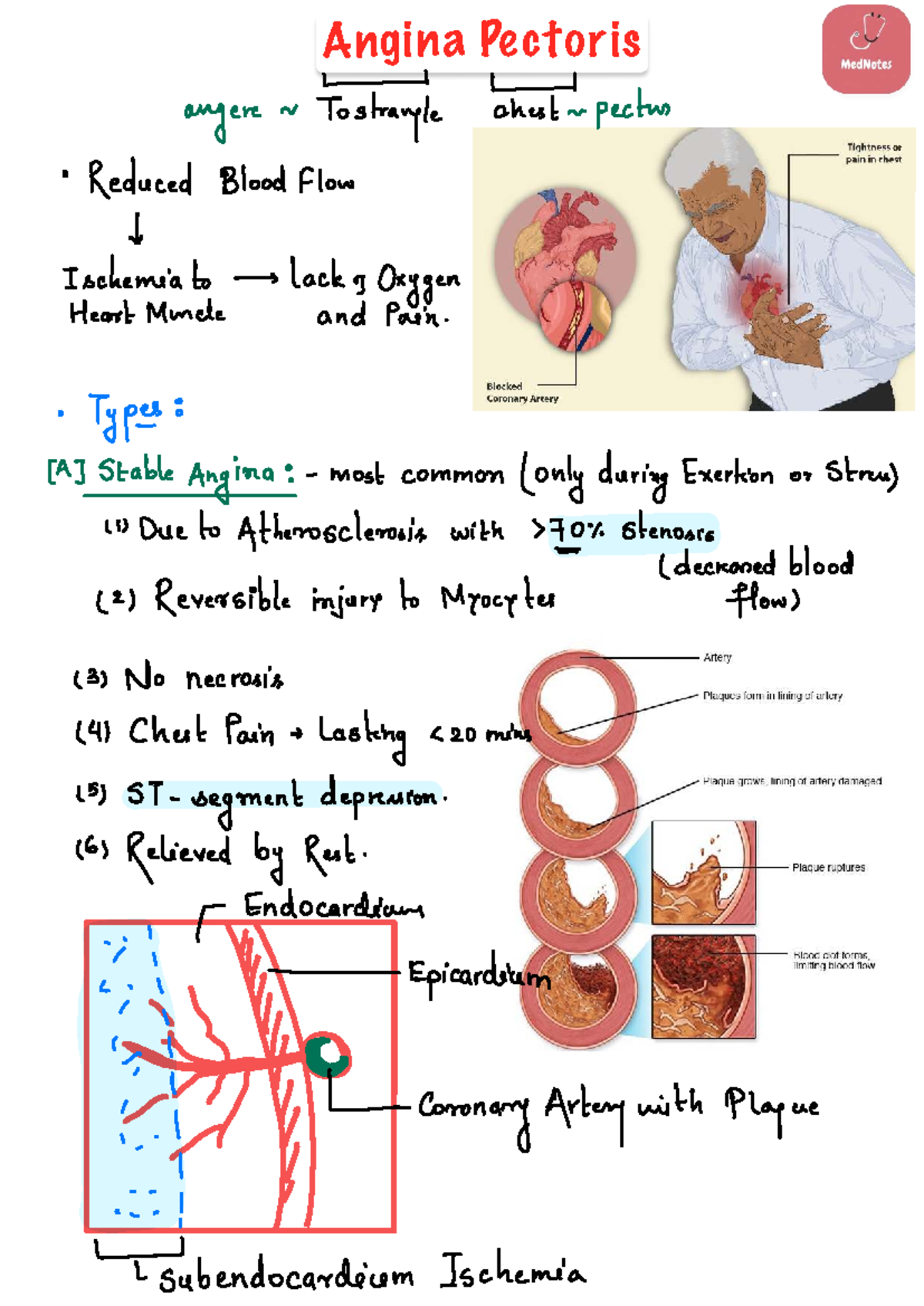Angina pectoris overview and types - BSN - Studocu