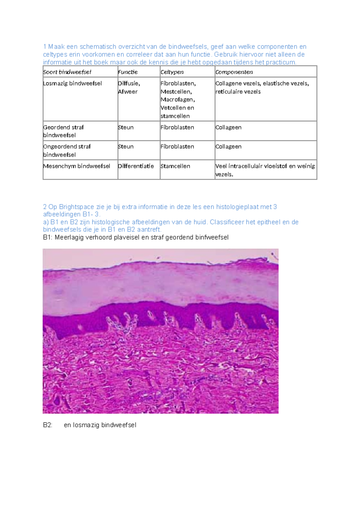 Werkgroep 4: Schematisch Overzicht Bindweefsels en Histologieanalyse ...