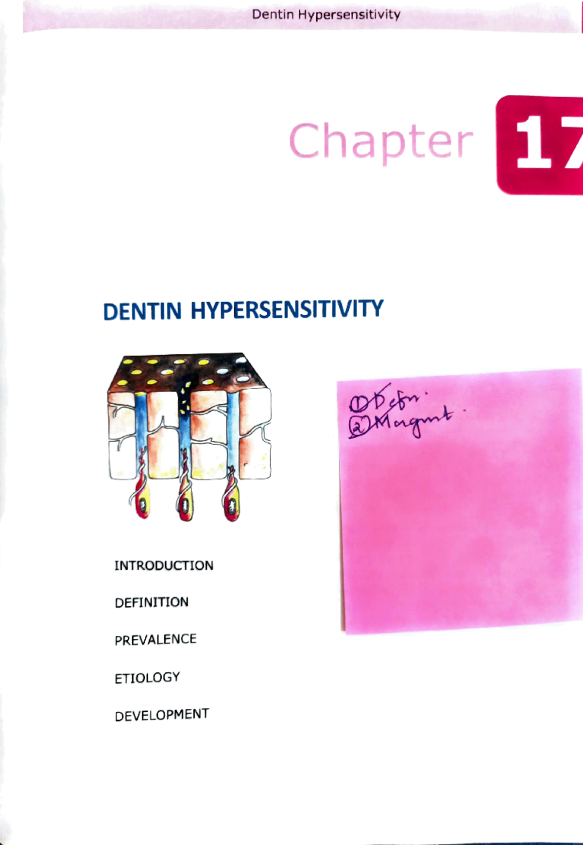 Dentin Hypersensitivity Overview - Chapter Notes (BDS) - Studocu