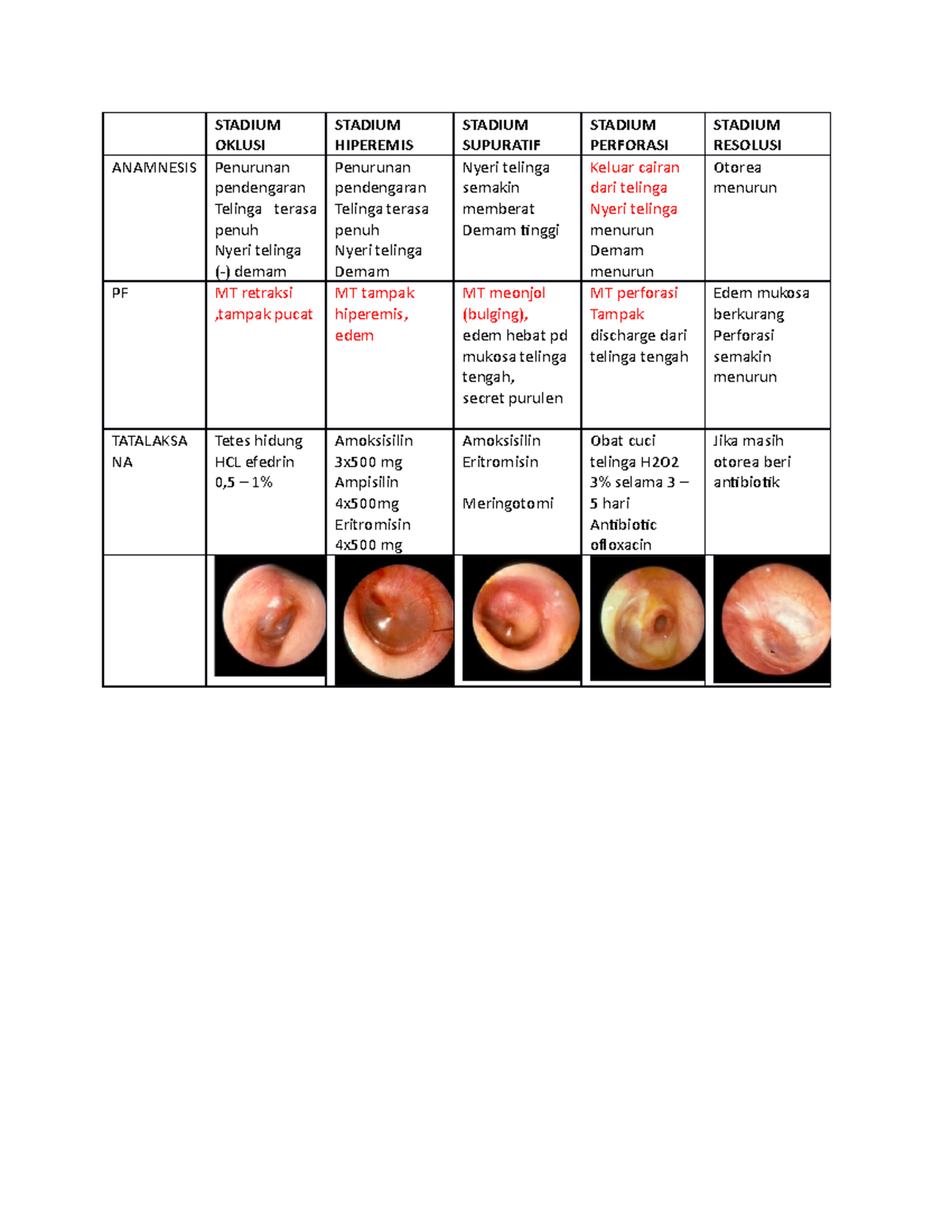 Title: Akut Otitis Media - Stadium and Treatment Guide - Studocu