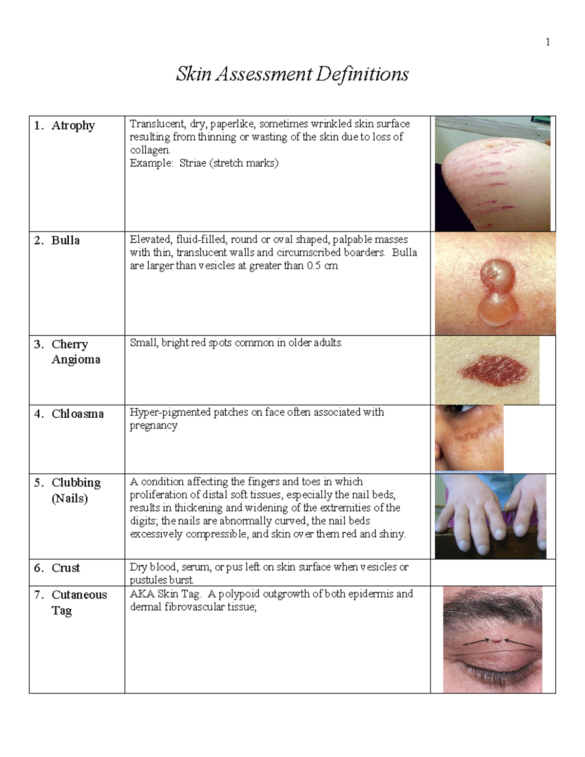 Skin Assessment Definitions: Key Terms and Conditions - Studocu