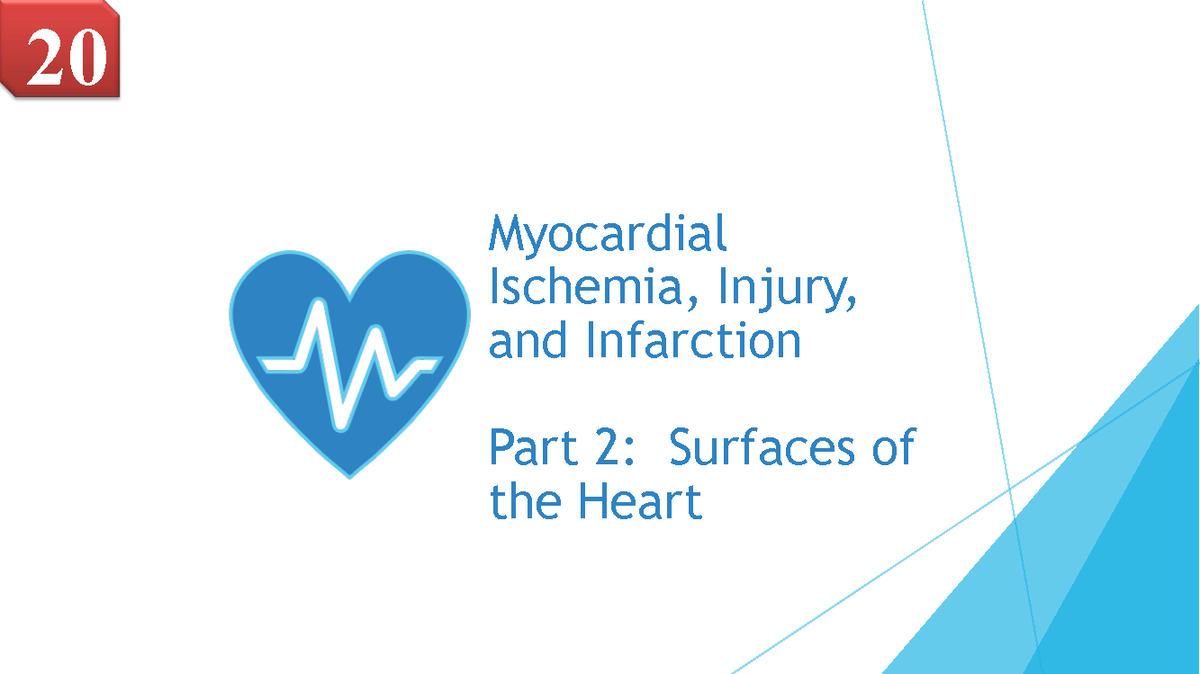 Myocardial Infarction (MI) Types & RV Analysis: Part 2 Insights - Studocu