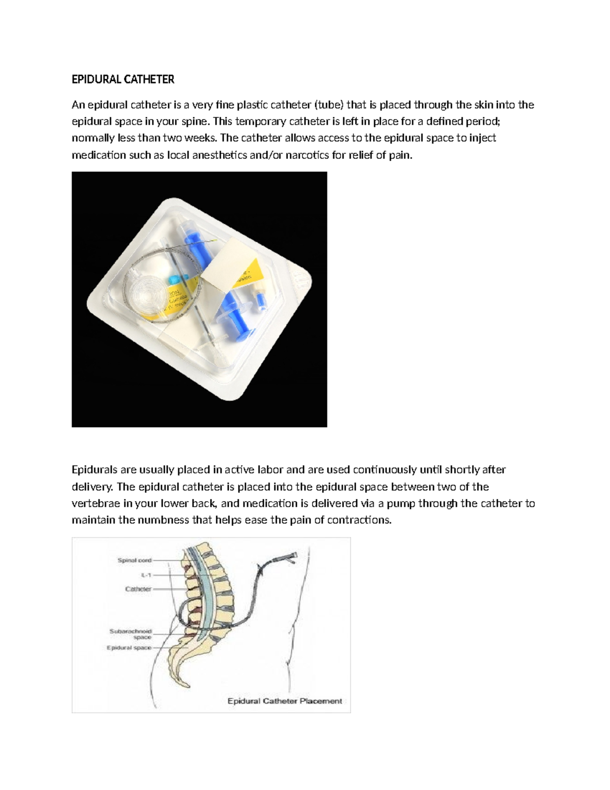 Epidural Catheter Uses