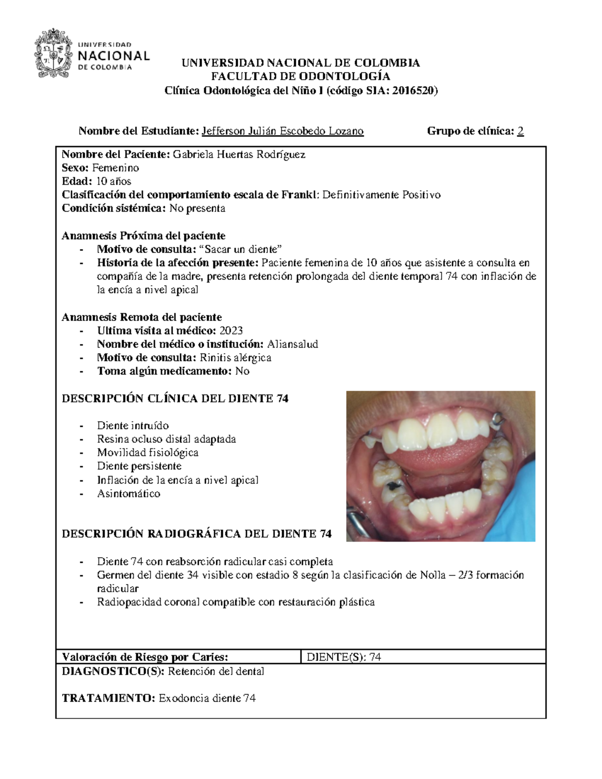 Exodoncia Simple del Diente Temporal 74 - Protocolo Niño I - Studocu