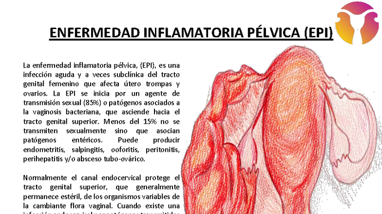 35 - EPI: Enfermedad Inflamatoria Pélvica - Diagnóstico y Tratamiento ...