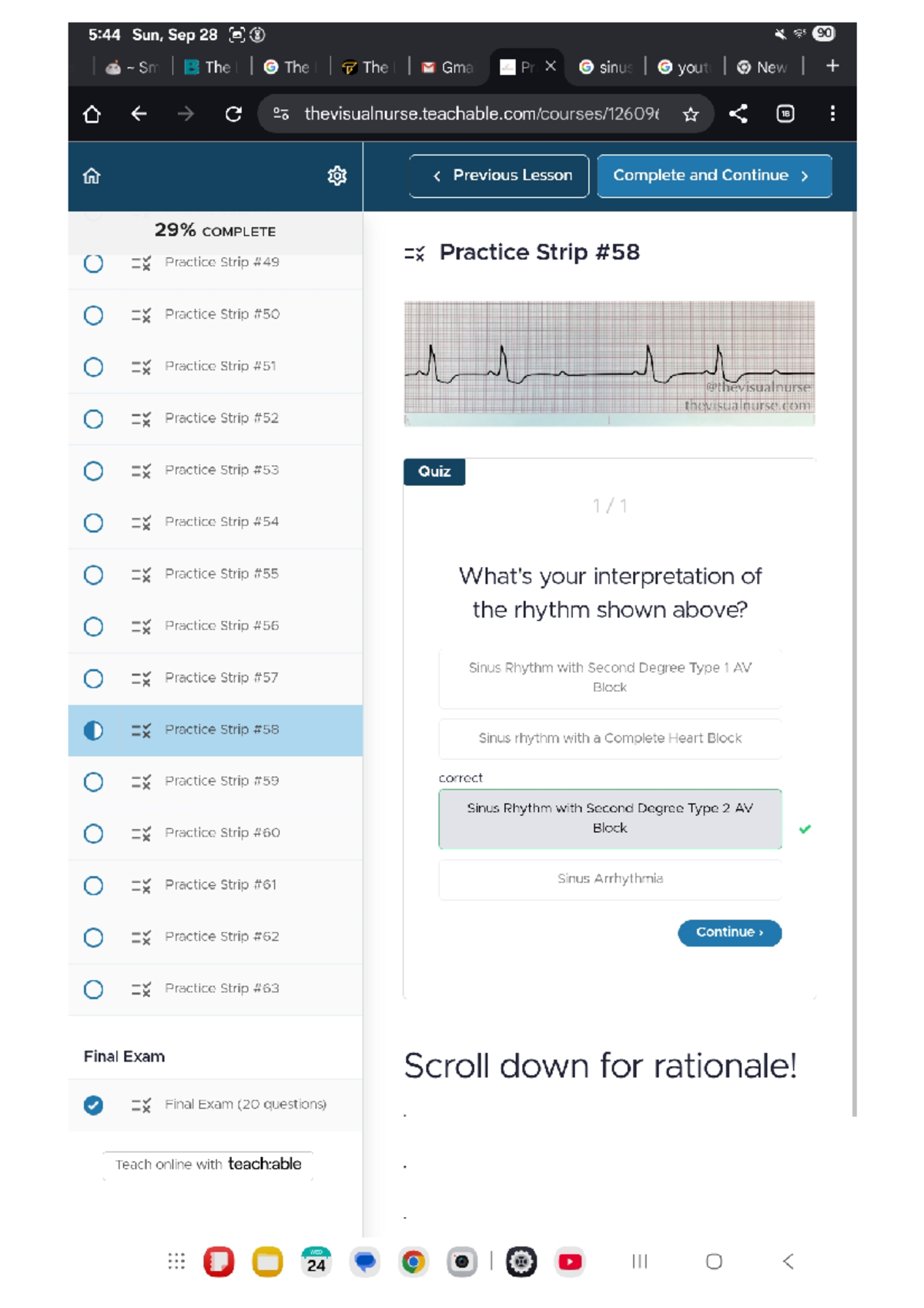 Final Exam Review: Sinus Rhythms & Heart Blocks (Course Code: 5:44 ...