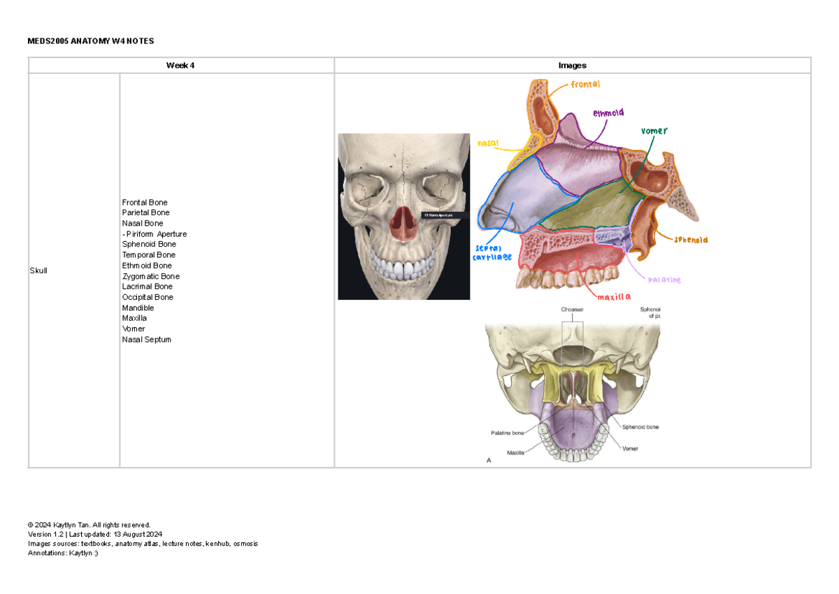 Anatomy W4 - Week 4 Images Skull Frontal Bone Parietal Bone Nasal Bone ...