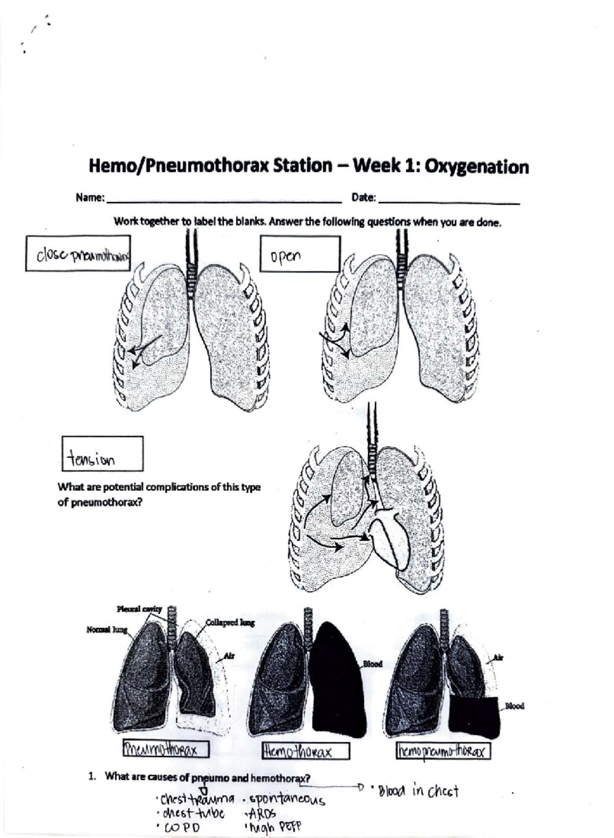 Pneumothorax case study with chest tube insertion - CC WEEK 2 - Studocu