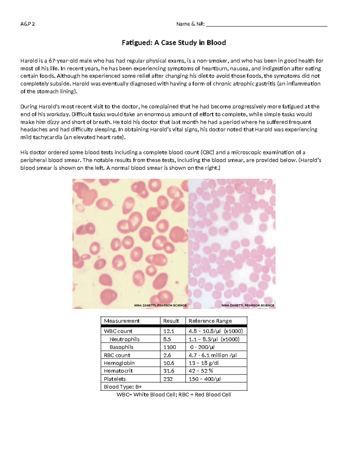 Blood Case Study: Anemia Diagnosis and Management in A&P 2 - Studocu