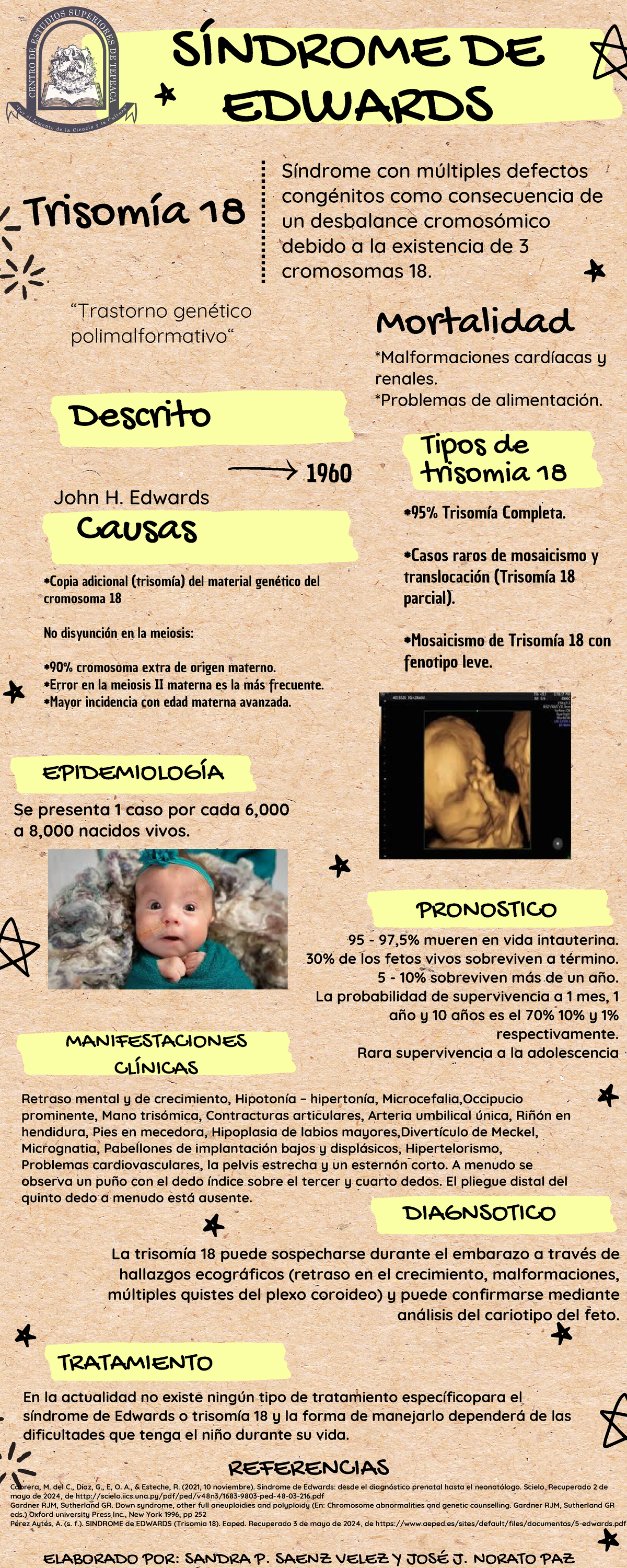 Síndrome de Edwards: Trisomía 18, Diagnóstico y Pronóstico - Studocu