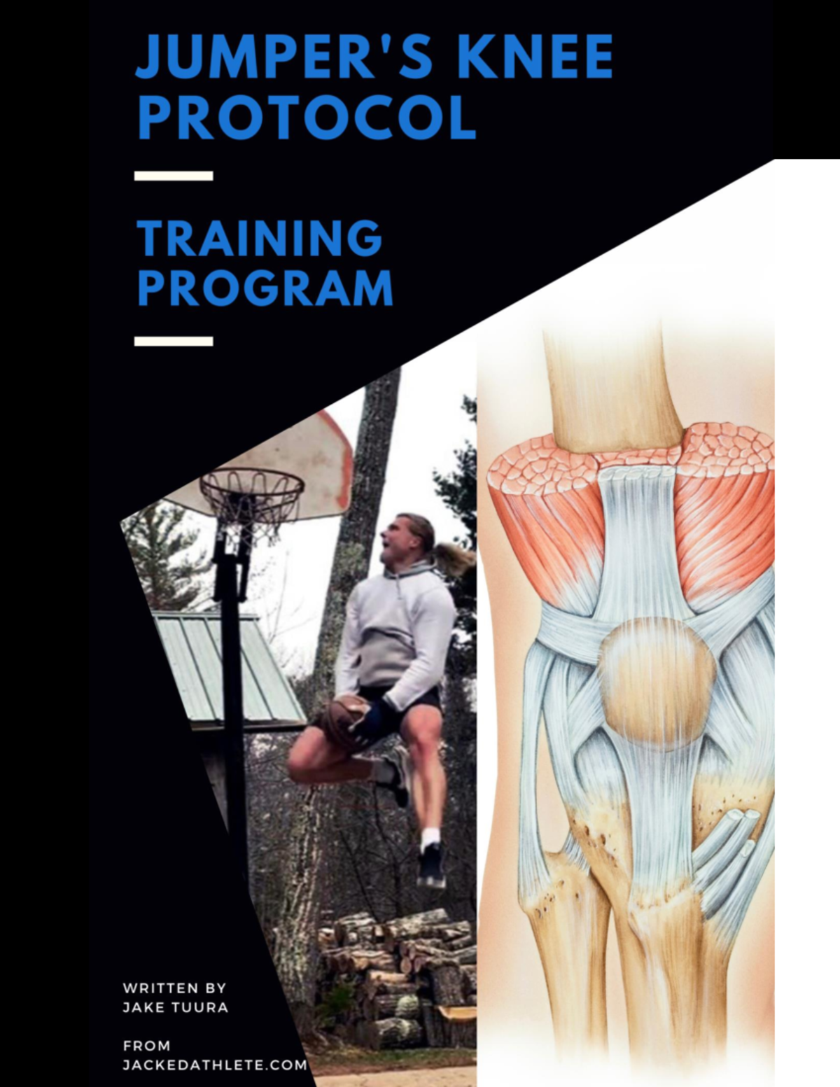 KNEE PROTOCOL: Jumper's Knee Rehab for Patellar Tendonitis - Studocu
