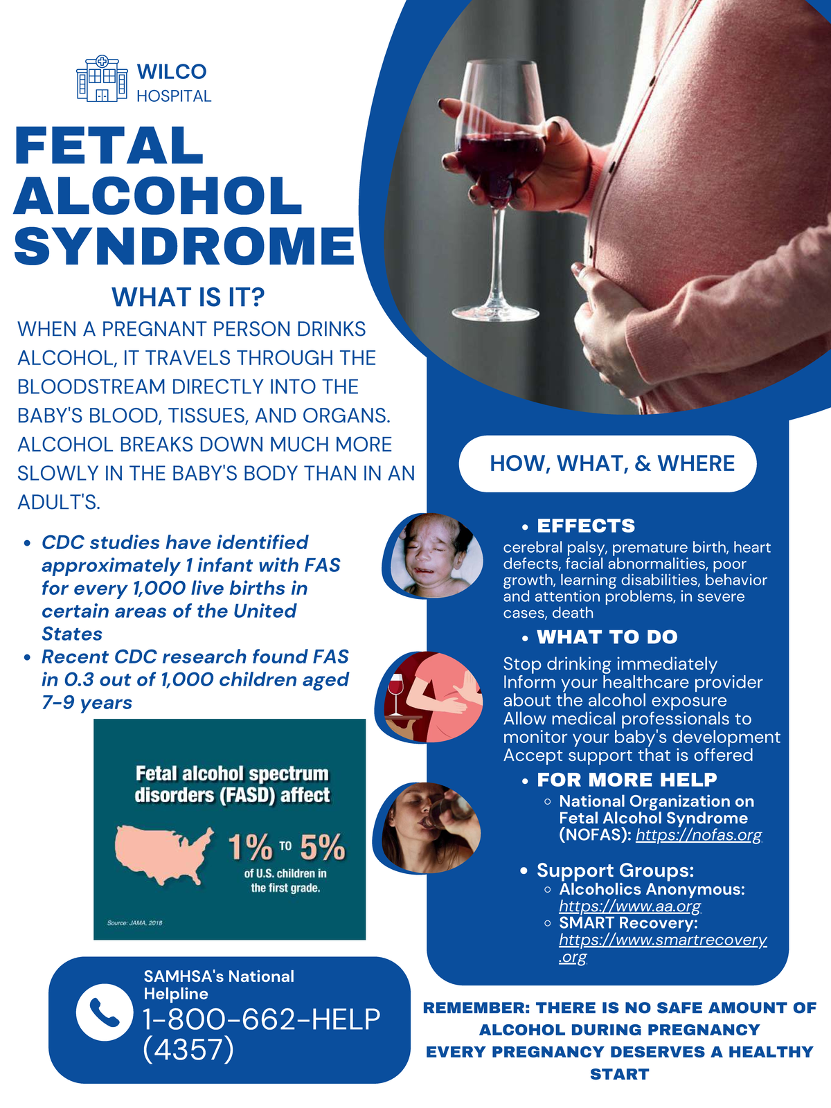 FAS Awareness Infographic: Effects, Risks, and Resources for Expecting ...