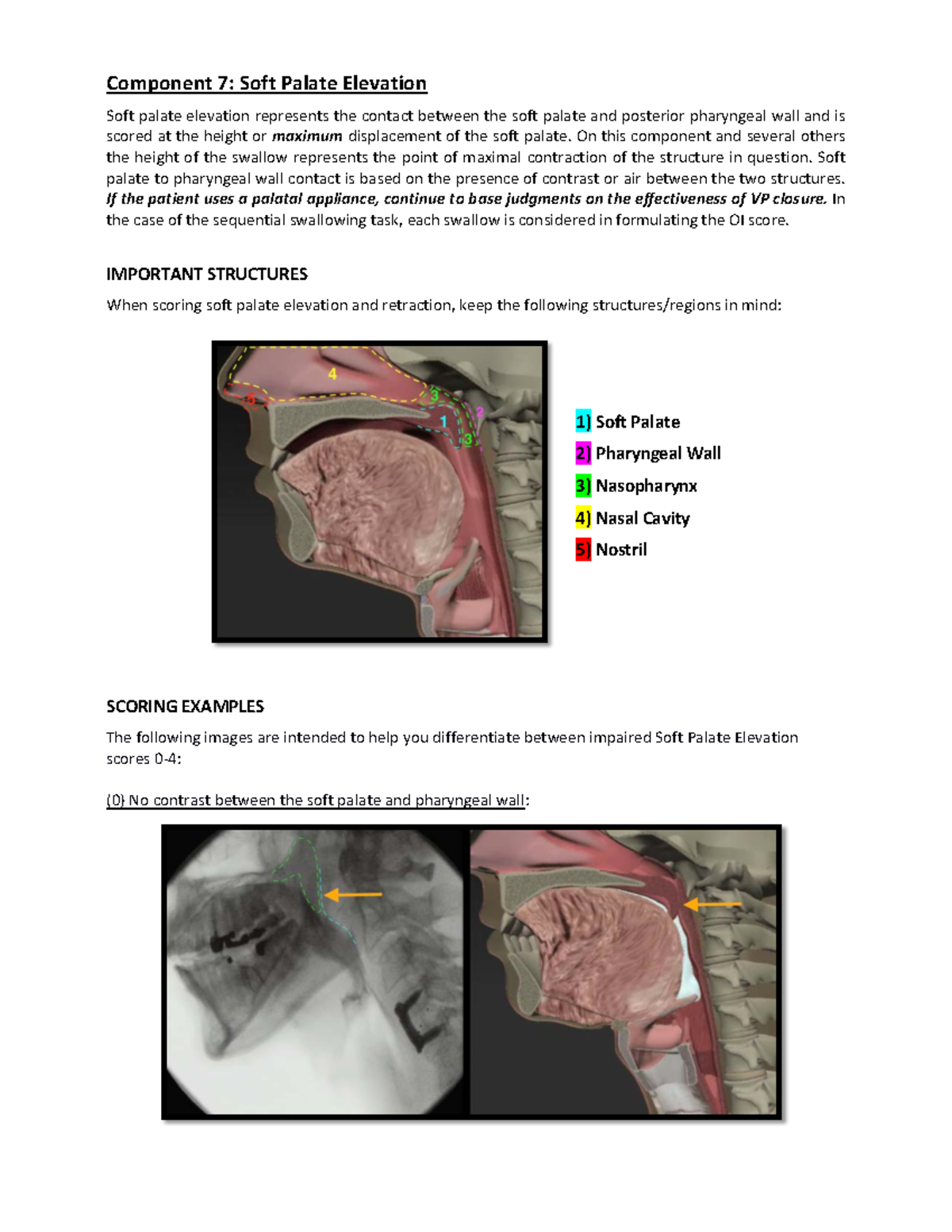 7-Soft Palate Elevation - Component 7: Soft Palate Elevation Soft ...