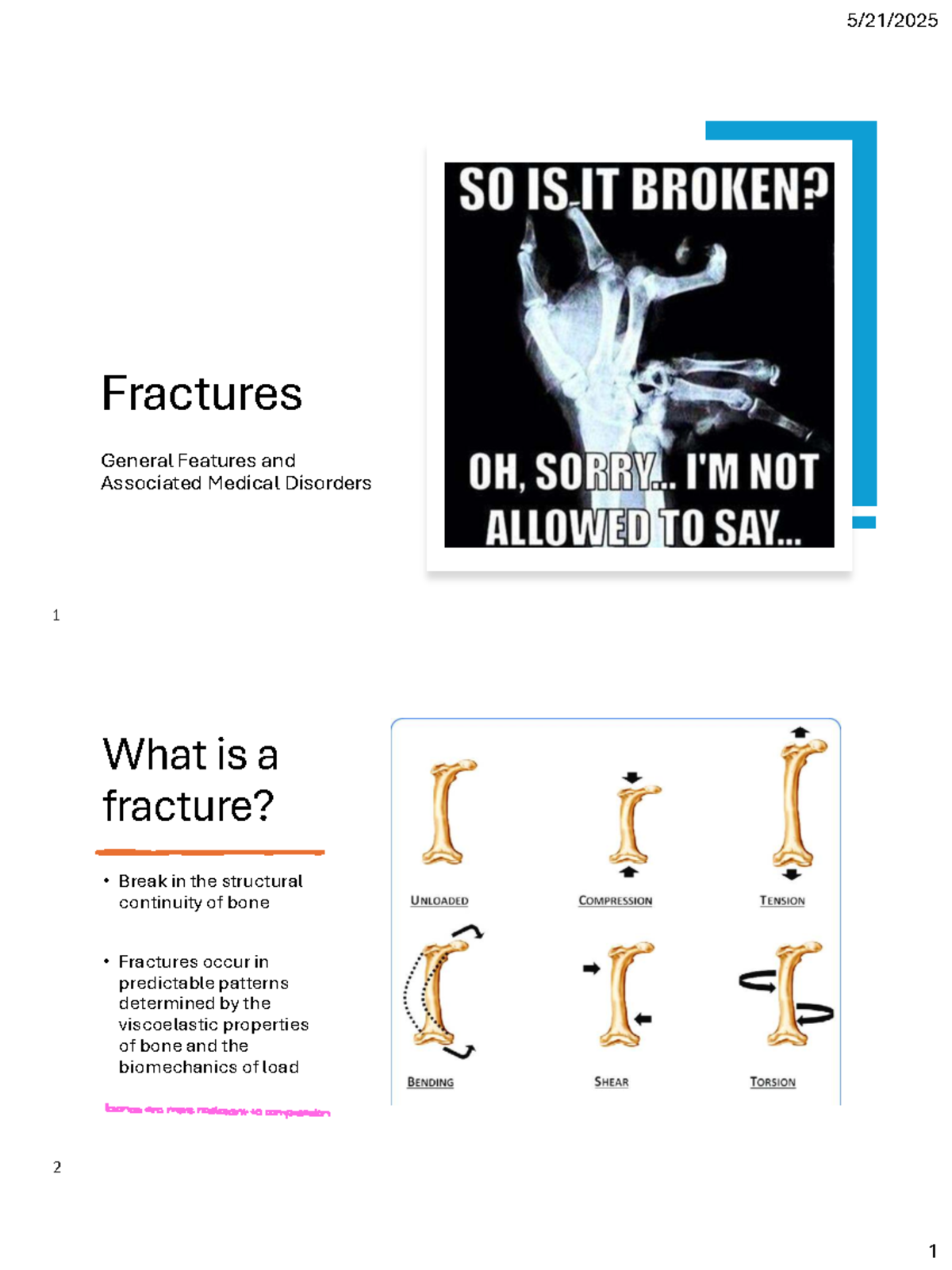Fractures: General Features & Radiologic Evaluation - Course Code 101 ...