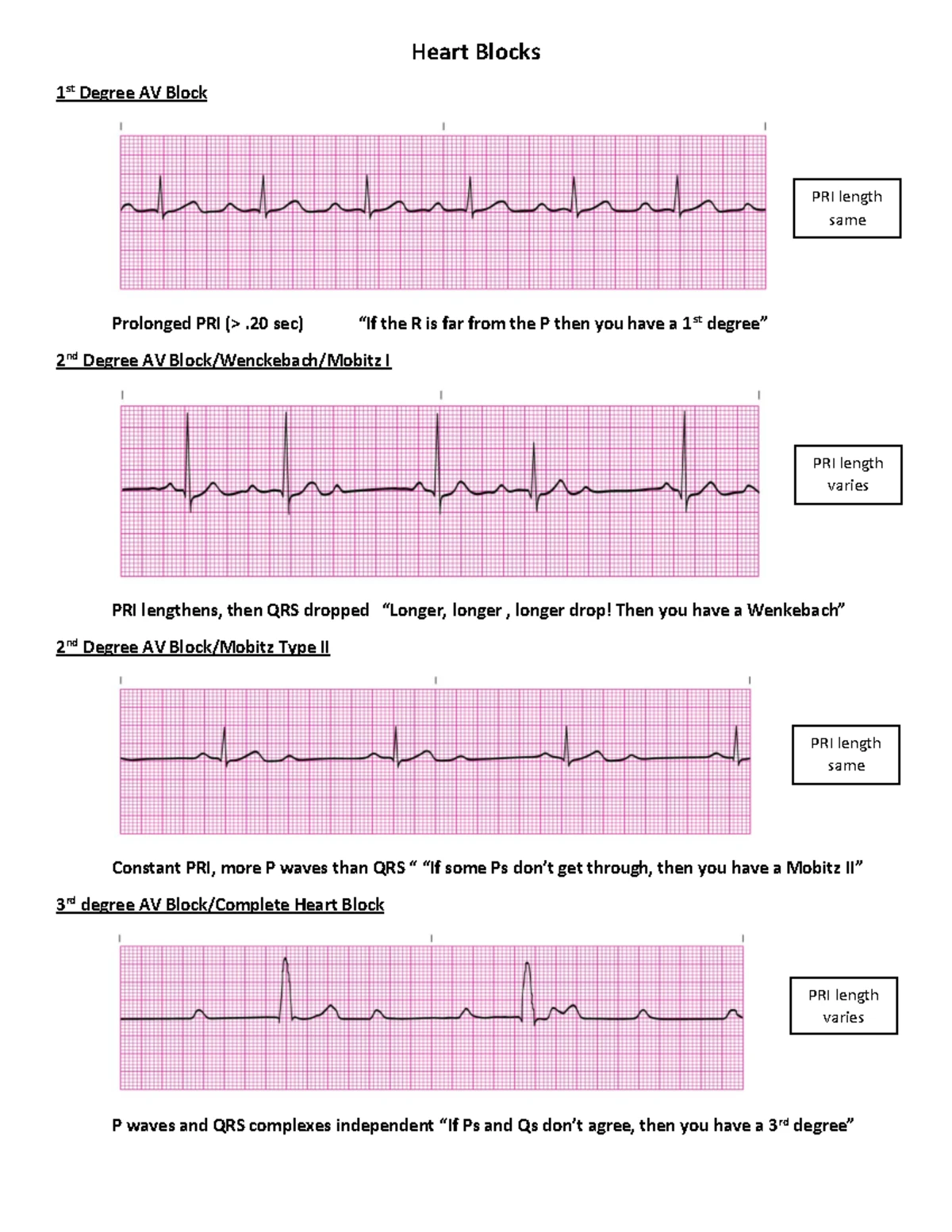 Study Packet EKG Test 1 - practice - Rhythm Test - Practice Test For ...