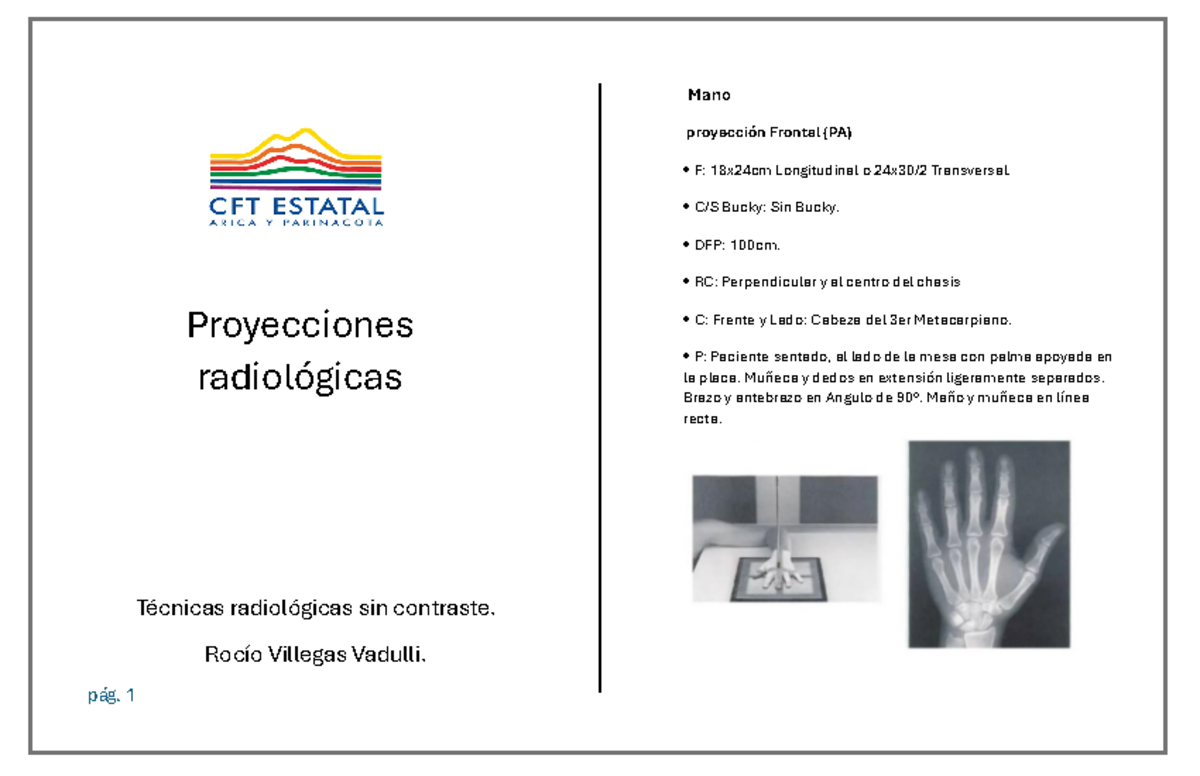 Proyecciones Radiológicas de Mano, Muñeca y Antebrazo - Análisis ...