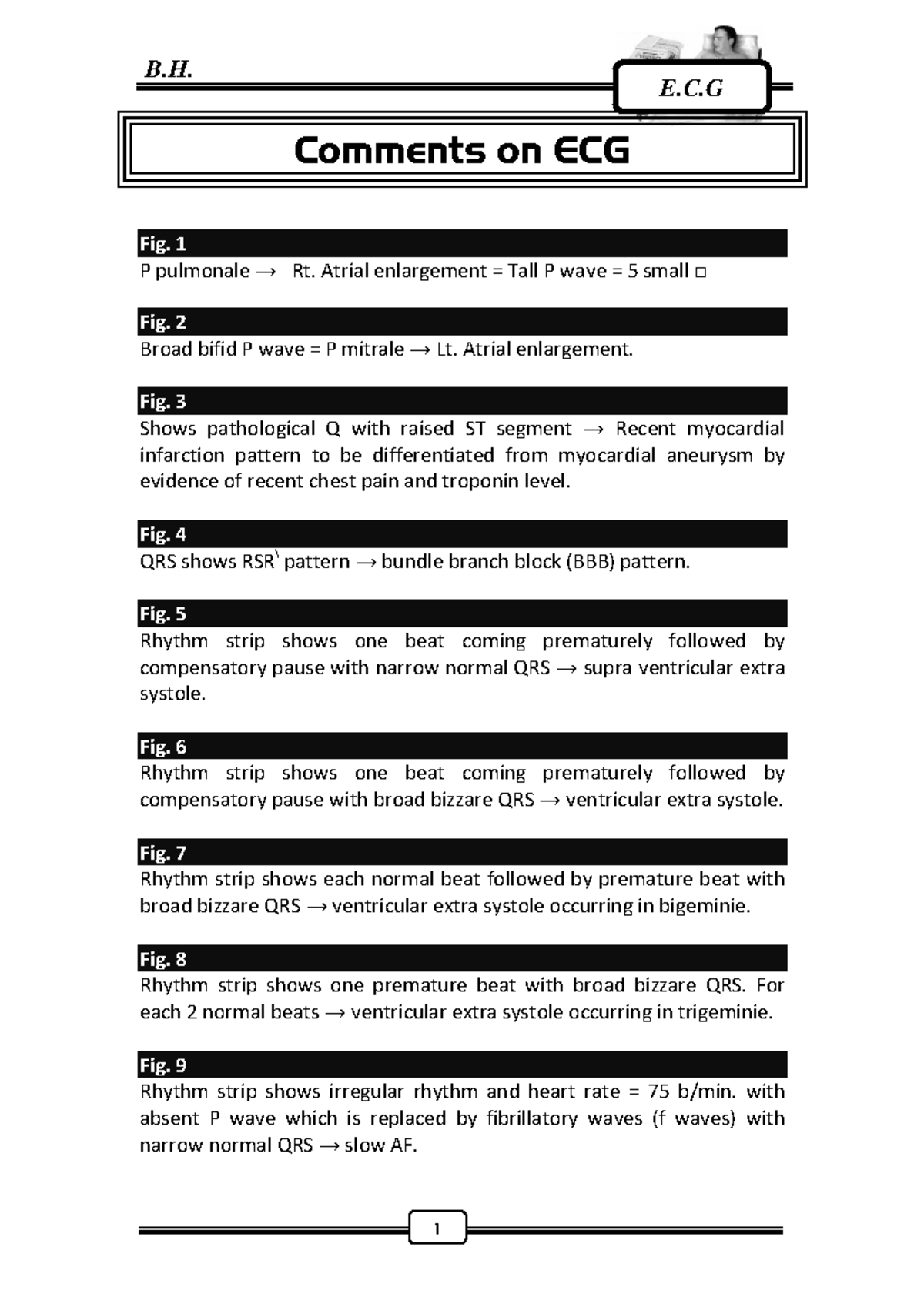 Keyanswers of ECG - ecg learning - E.C Comments on ECG Fig. 1 P ...