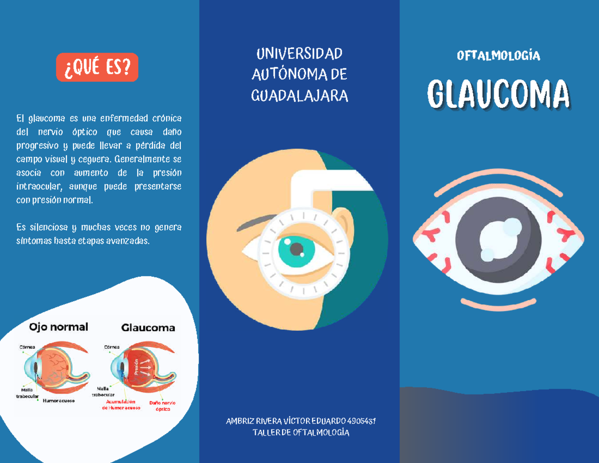 TALLER DE OFTALMOLOGÍA: Tríptico sobre el Glaucoma - Studocu