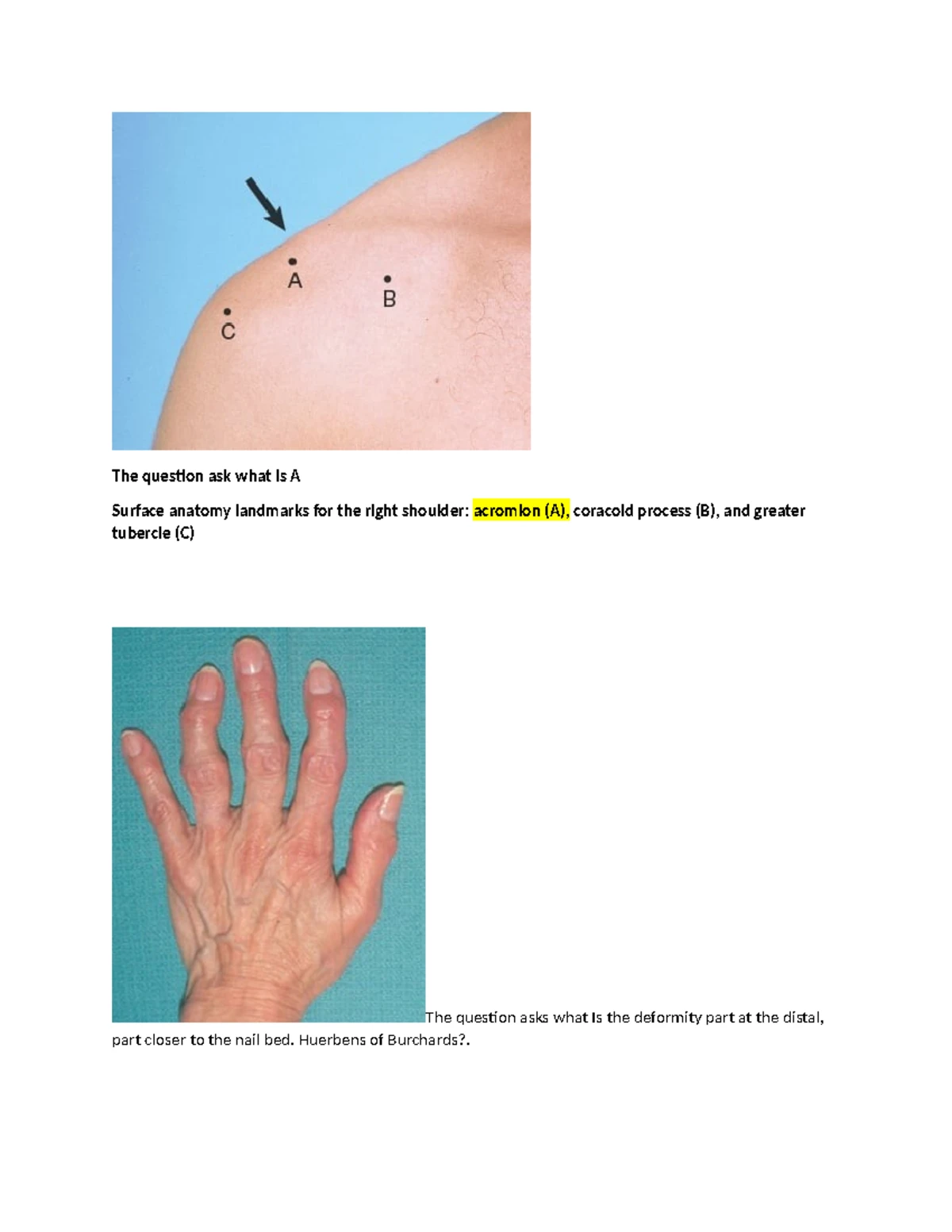 NR 509 Final Exam - Study guide - A 44-year-old female mathematician ...