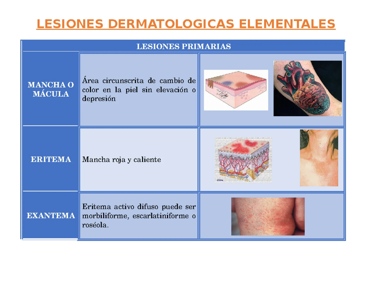 Lesiones Elementales de la Piel: Clasificación y Tratamiento - MAS ...