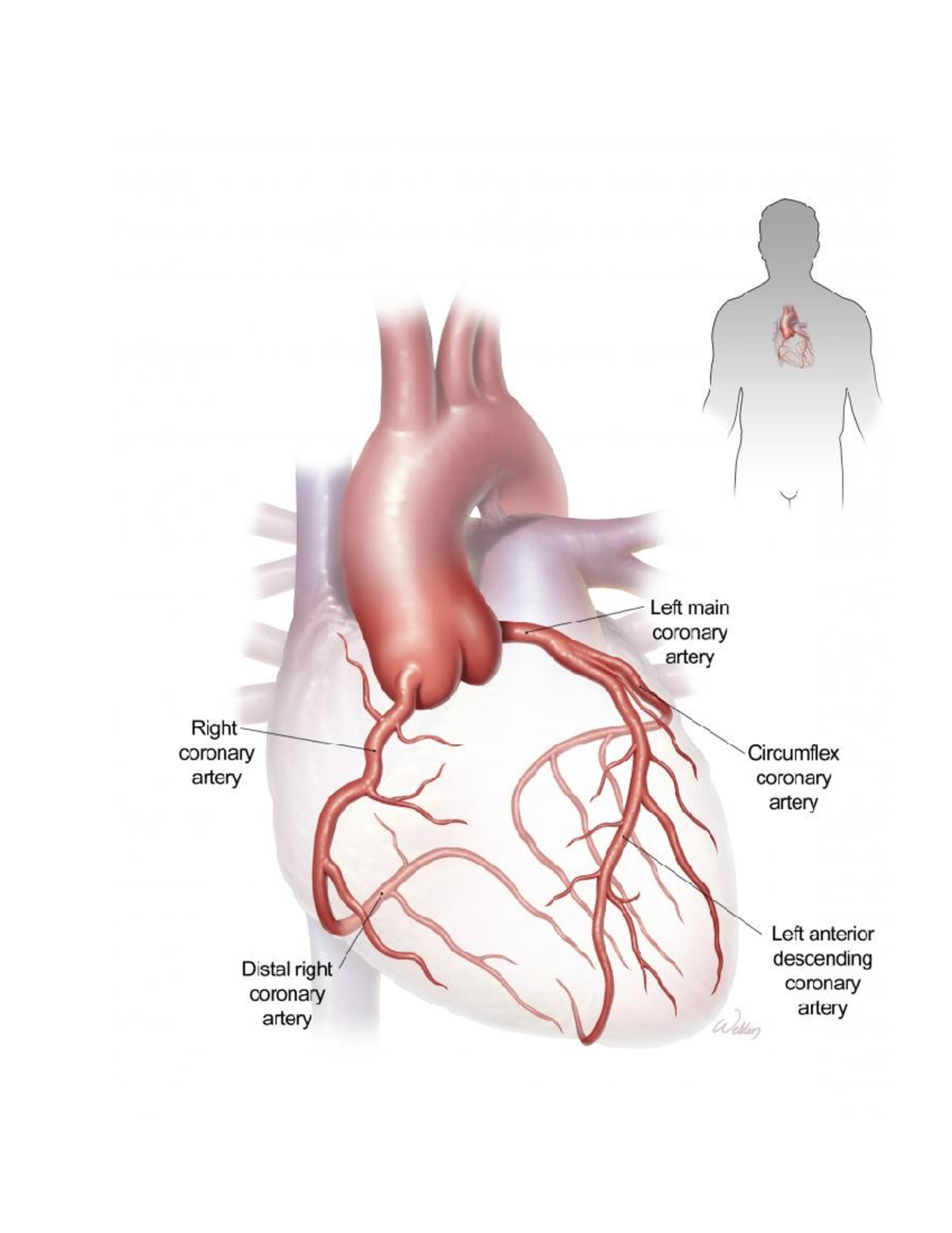 Coranary+arteries - Coronary arteries - PN 108 - Left main coronary ...