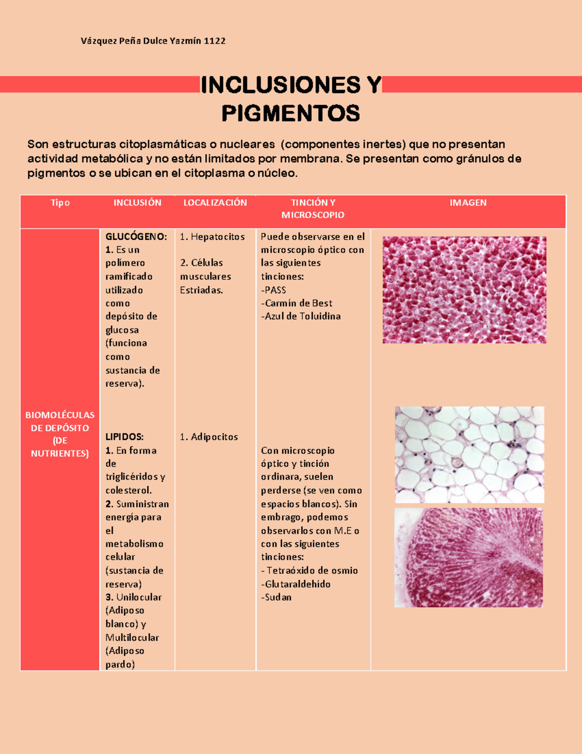 Tabla de Inclusiones Histológicas y Pigmentos - Estudio Avanzado - Studocu