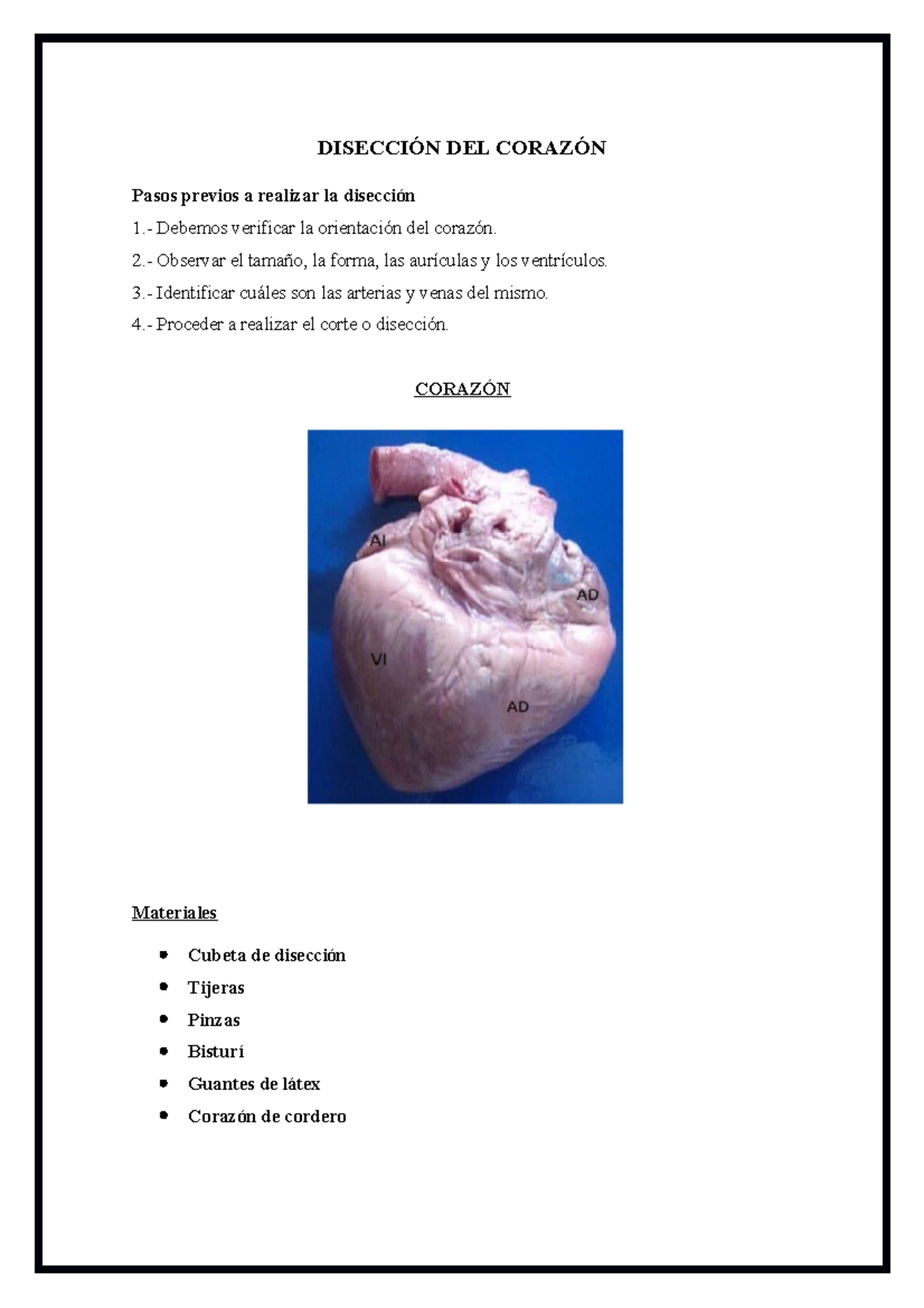 Hoja De Trabajo De Disección Del Corazón DISECCIÓN DE UN CORAZÓN,