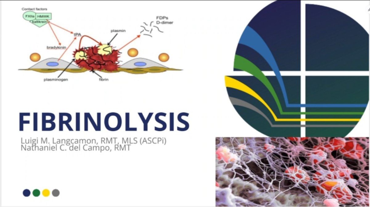Fibrinolysis - Contact factors FXIIa HMWK FDPs Kalikrein plasmin tPA ...