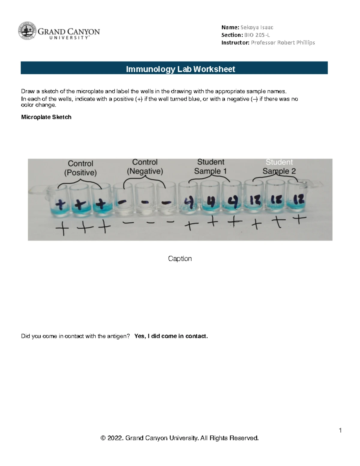 Microbiol 101: Infectious Disease Lab Worksheet and Data Collection ...