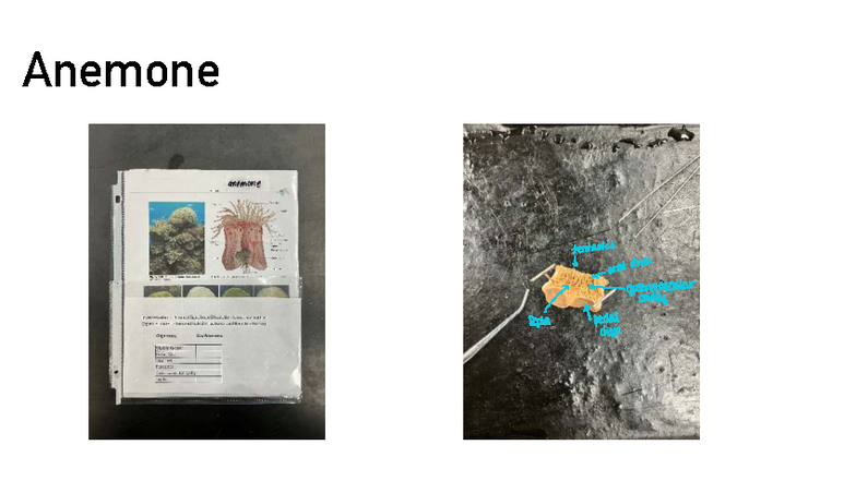 Invertebrate Lab (BIO 101): Animal Dissection Explanations and ...