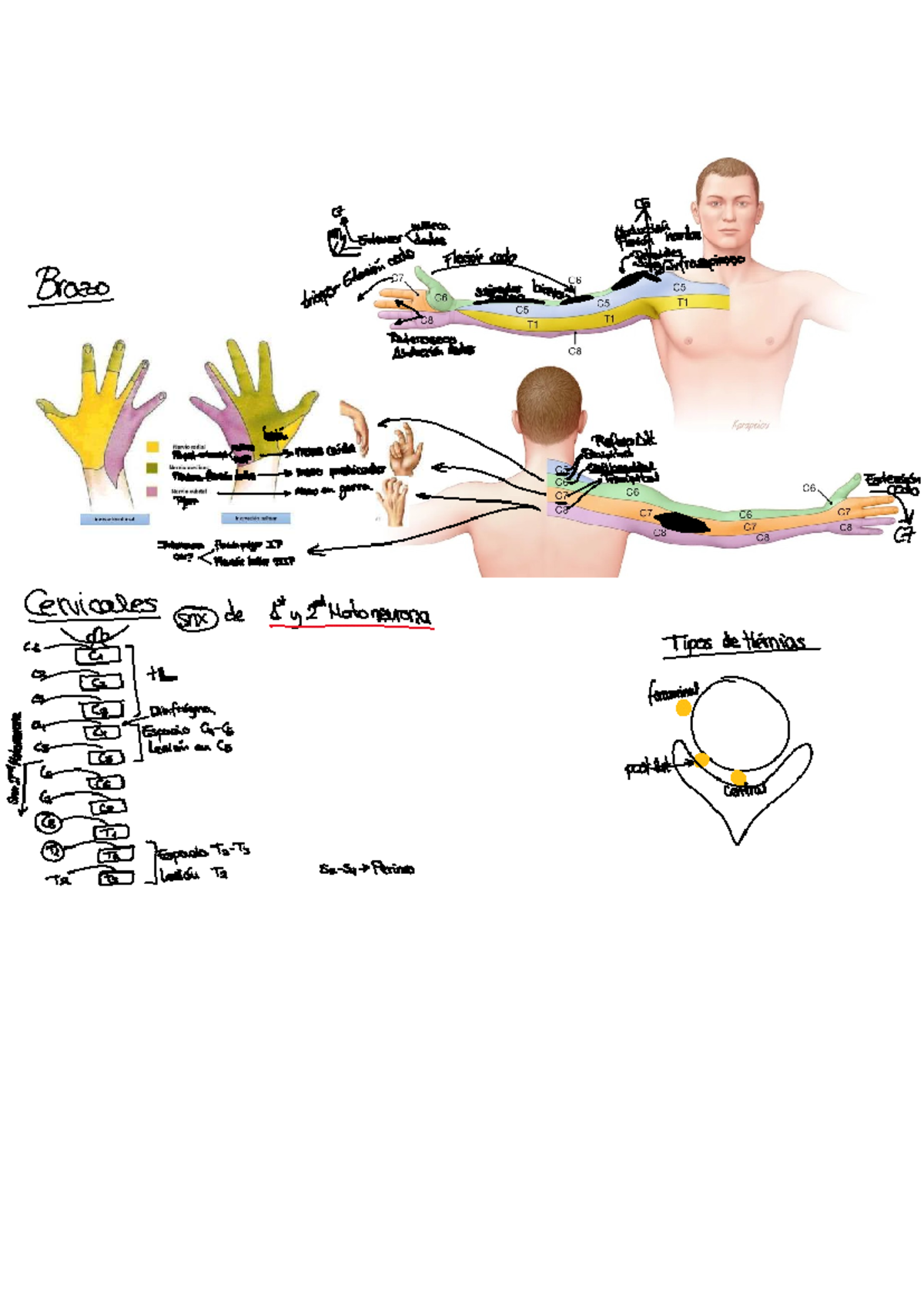 Neuro - Arm: Diagnóstico y Tratamiento de Tumores Cerebrales - Studocu