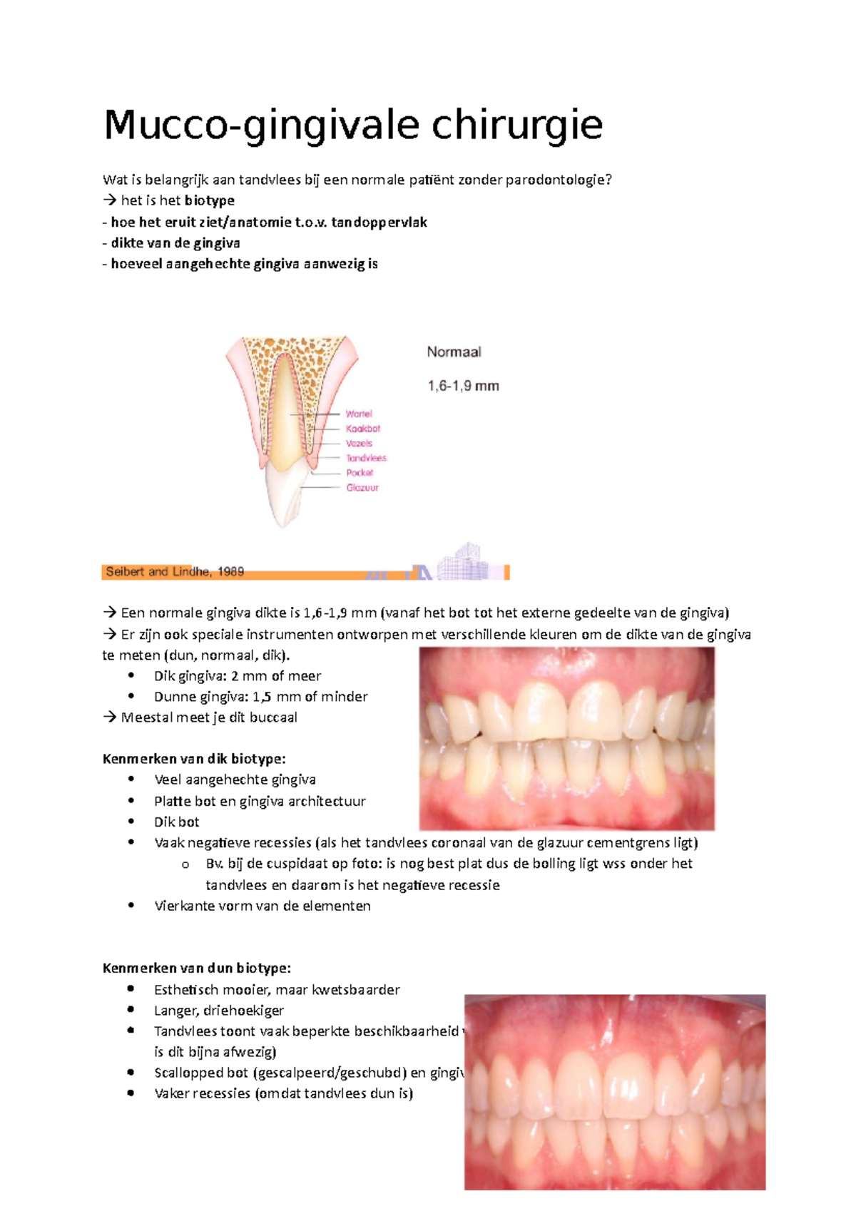 Mucco-gingivale Chirurgie: Diagnostiek en Behandeling van Recessies ...