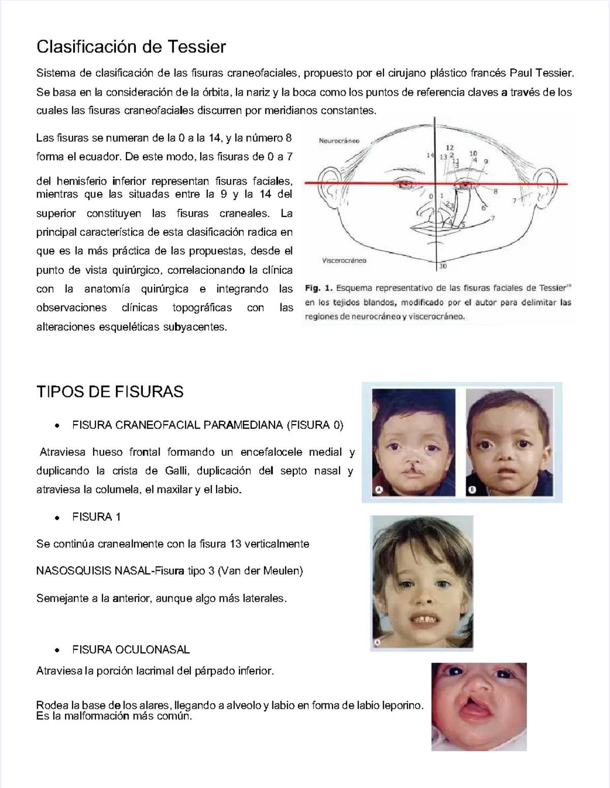 Clasificación de Tessier: Fisuras Craneofaciales y su Anatomía - Studocu