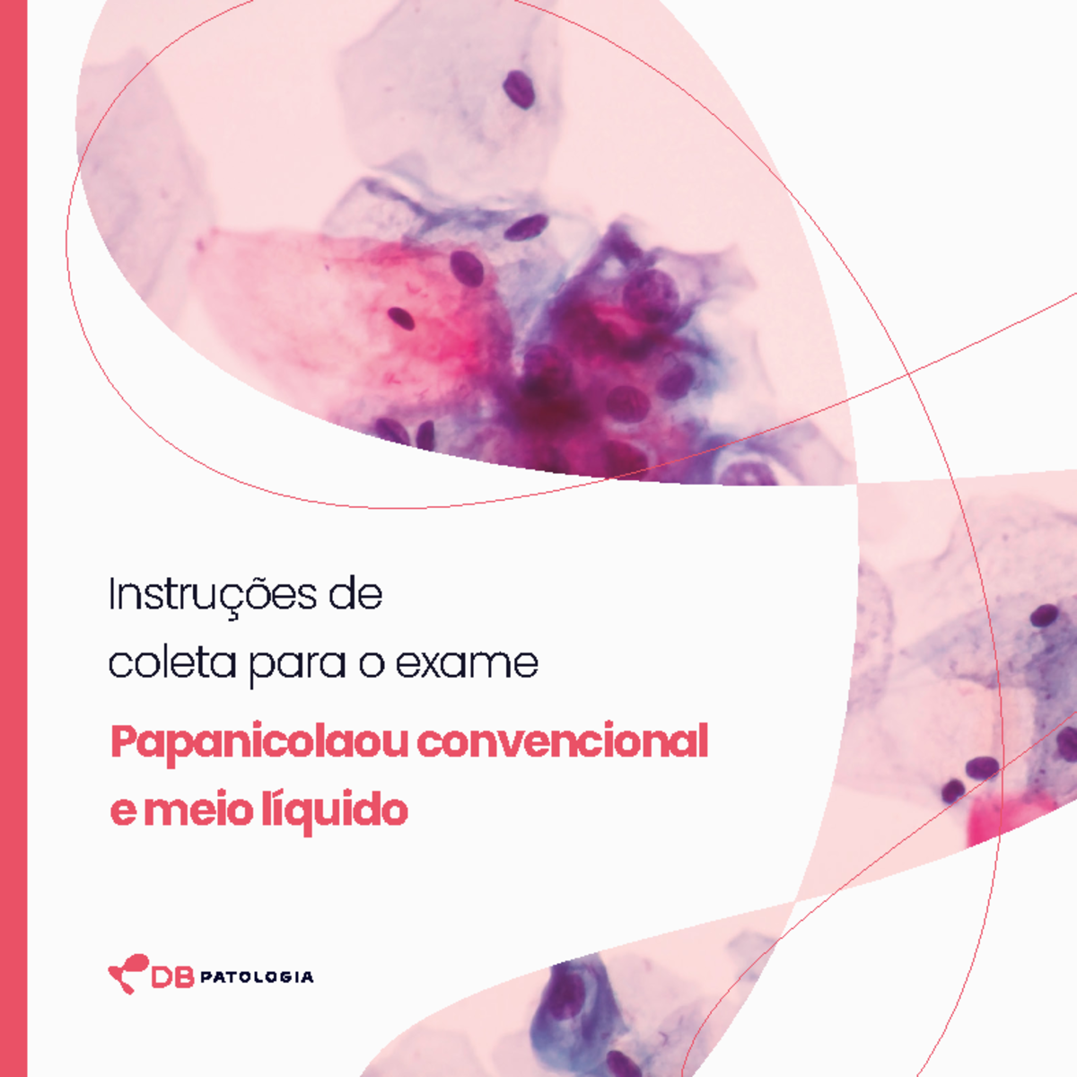 Instruções para Coleta de Exame Papanicolaou RQ 0535 em Meio Líquido ...