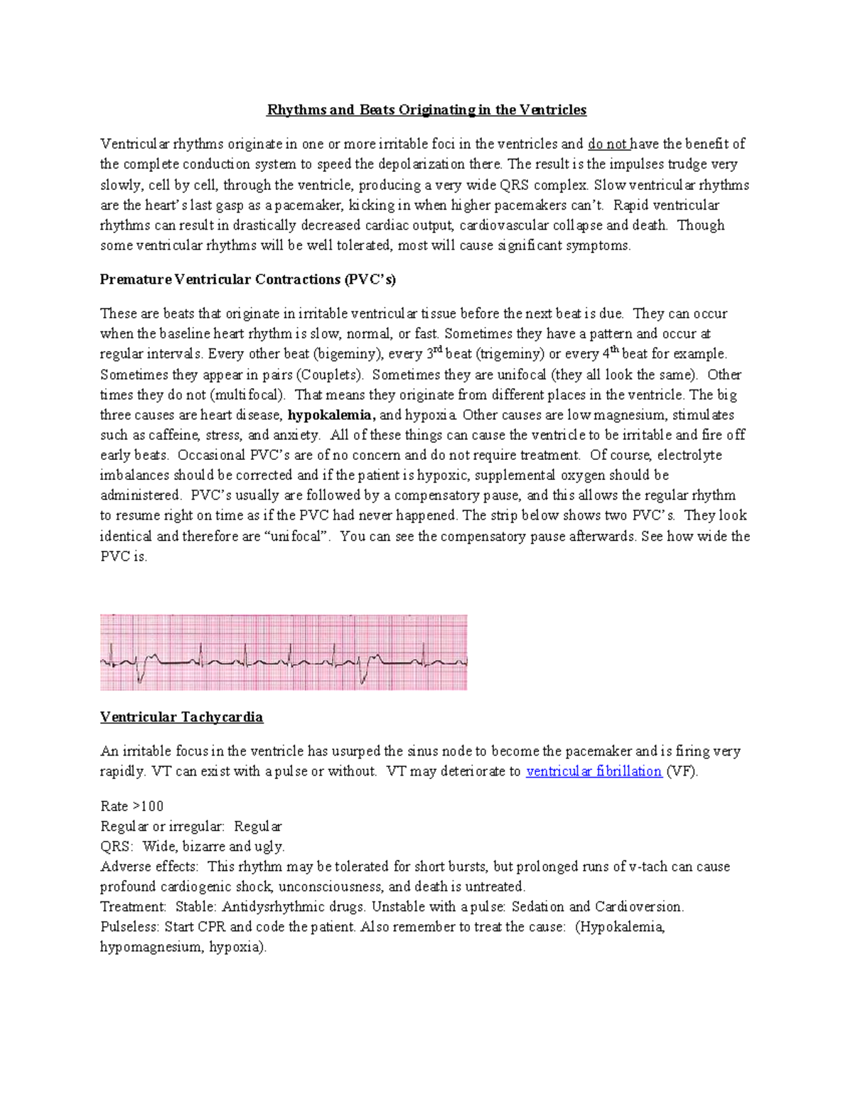 Understanding Ventricular Rhythms: Types, Causes & Treatments - Studocu
