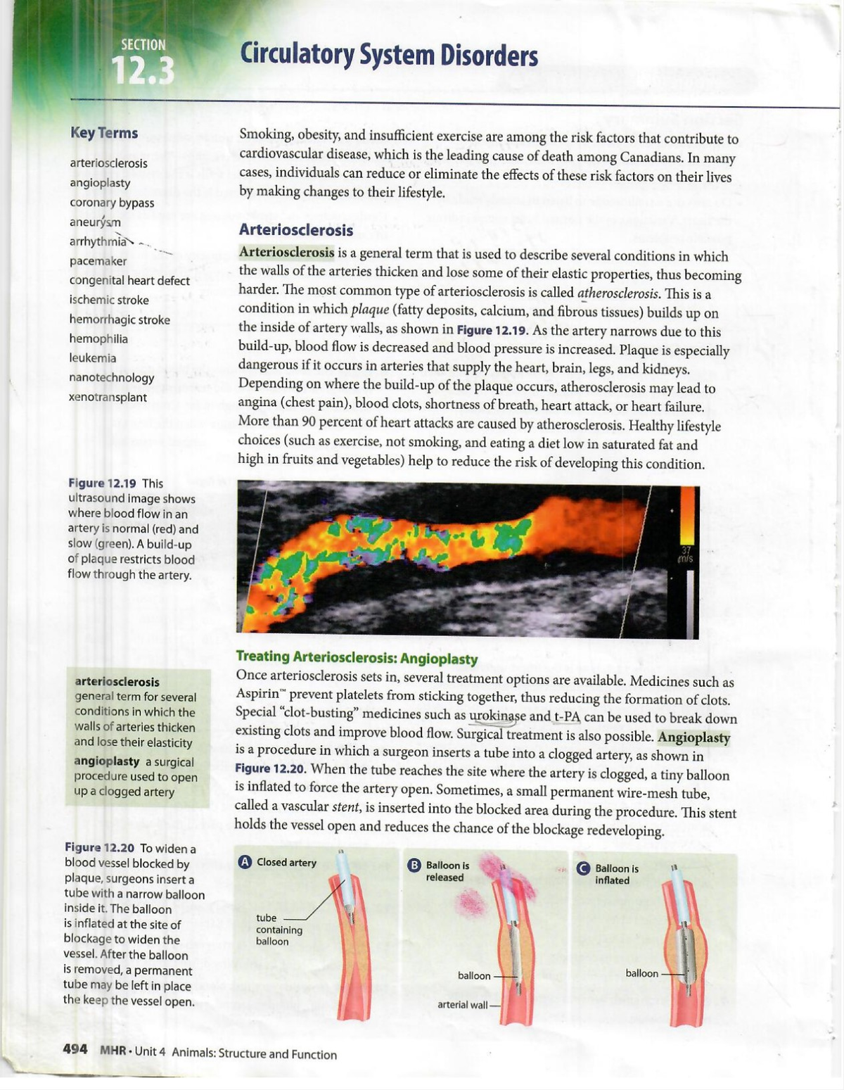 12.3 Circulatory System Disorders: Key Terms and Treatments Overview ...